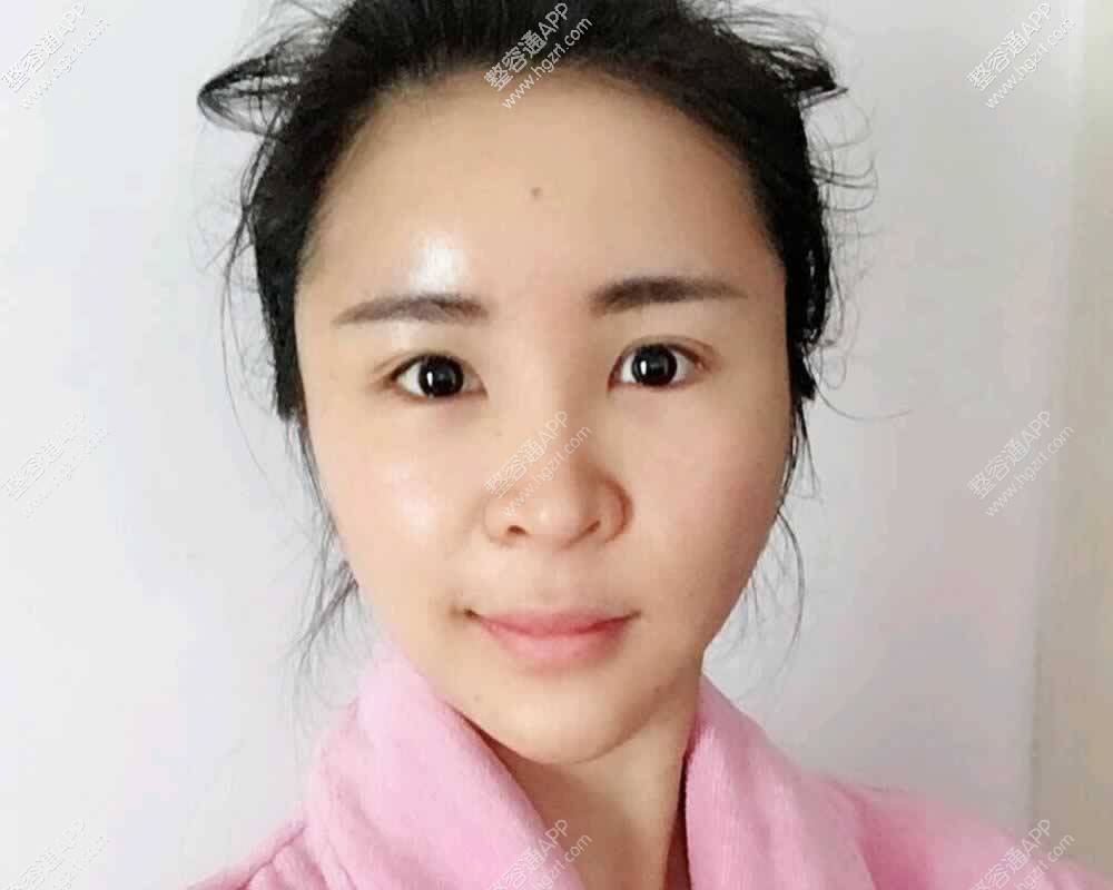 满脸油光油光满面皮肤油腻大山谷图库